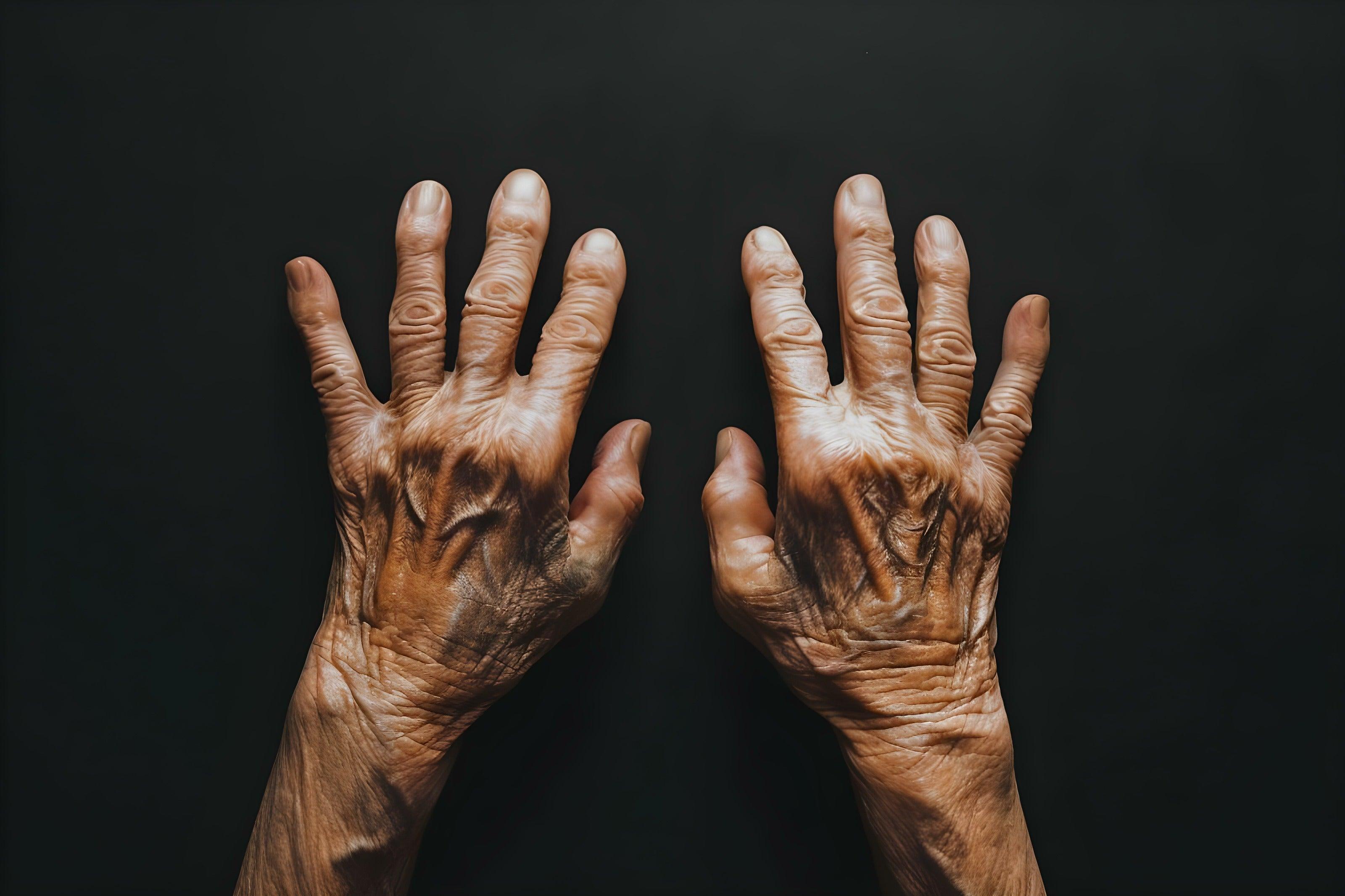 Top Tips for Arthritis Relief | NatraCure - NatraCure