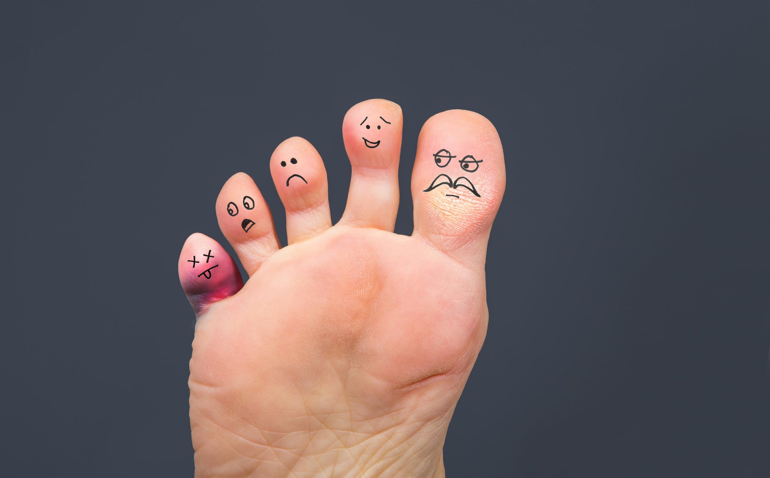 Pinky Toe Bunion: Causes, Symptoms & Care - NatraCure