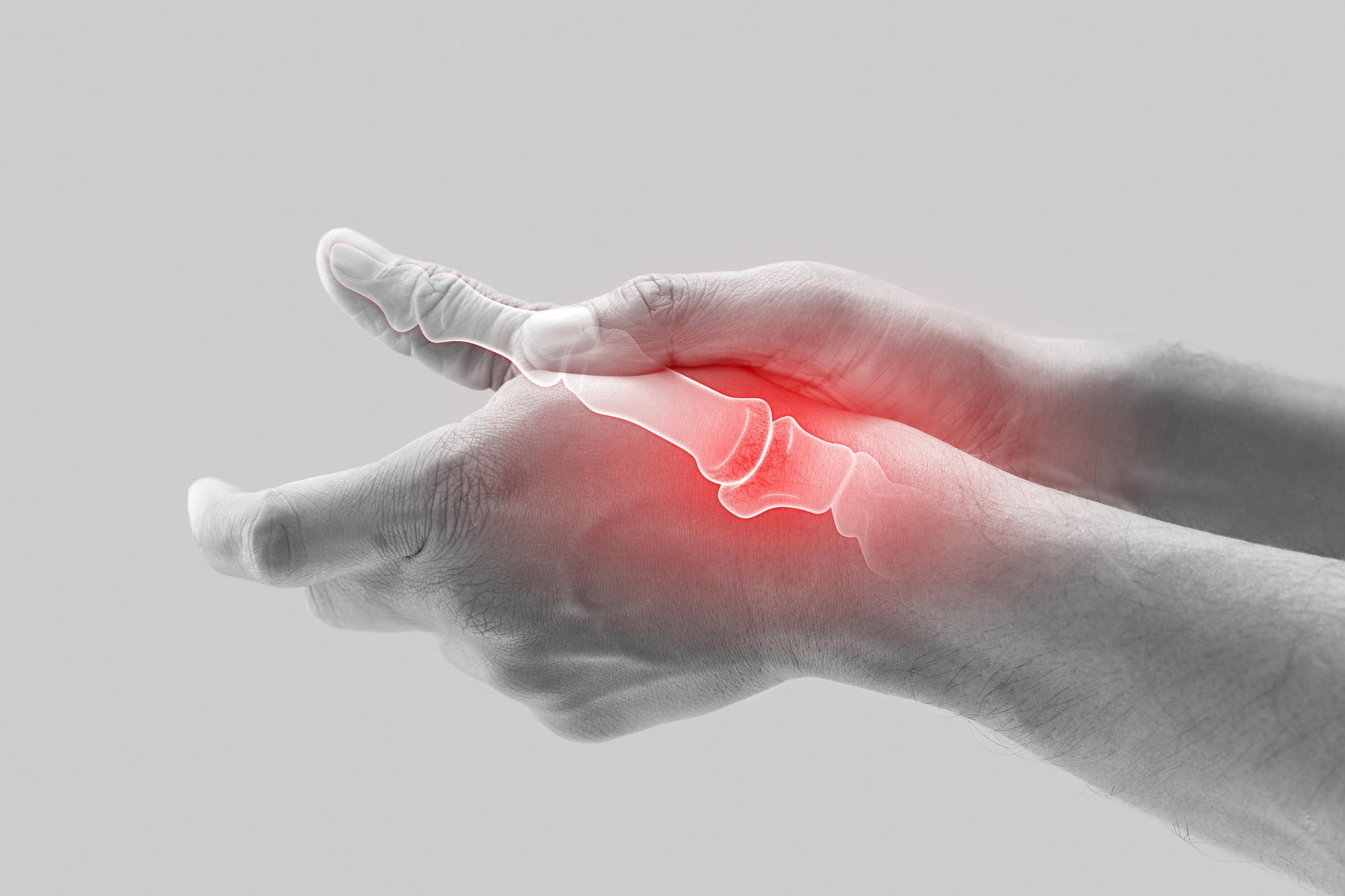 Jammed Thumb: Signs, Treatment, and Recovery | NatraCure - NatraCure