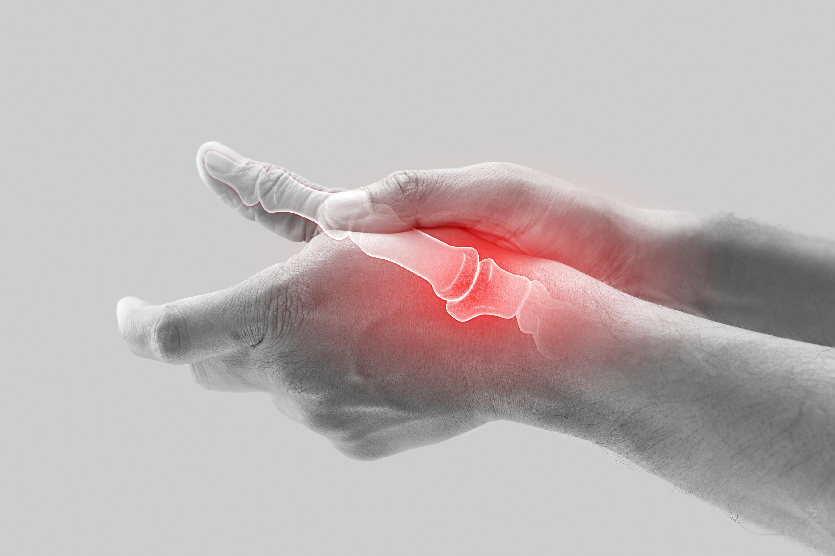 Jammed Thumb: Signs, Treatment, and Recovery | NatraCure - NatraCure